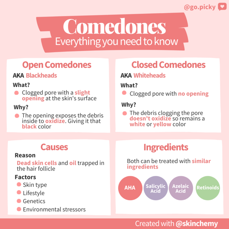 Skincare FAQ with @Skinchemy: Comedogenic vs. Non-comedogenic