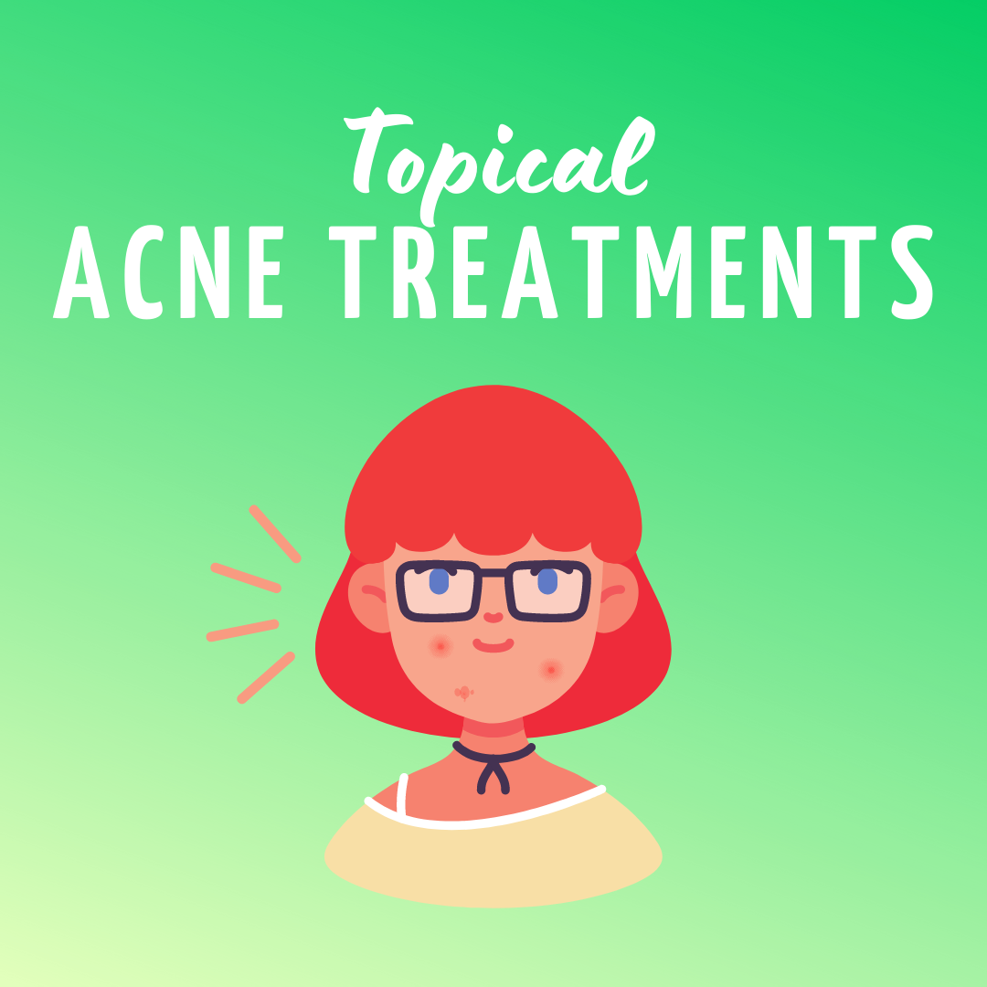 All About Topical Acne Treatments