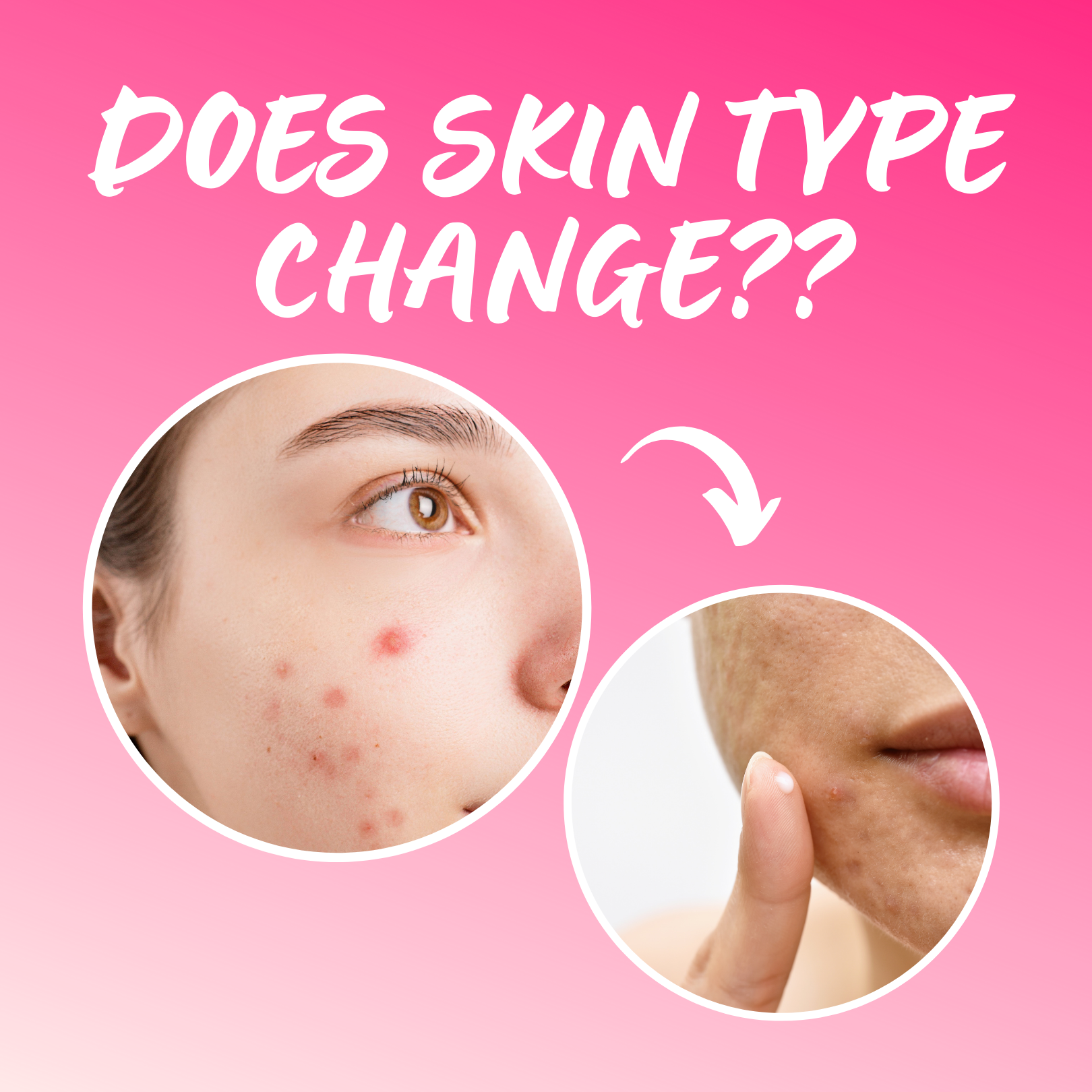 Does Skin Type Change? - Picky Skincare Blog